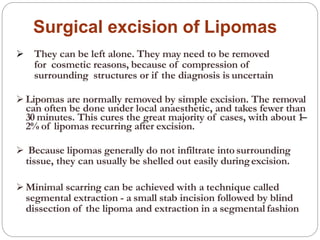 Lipoma | PPTX