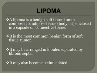 Lipoma | PPTX