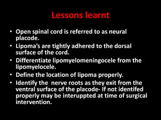 Lipomyelocele powerpoint presentation. | PPTX
