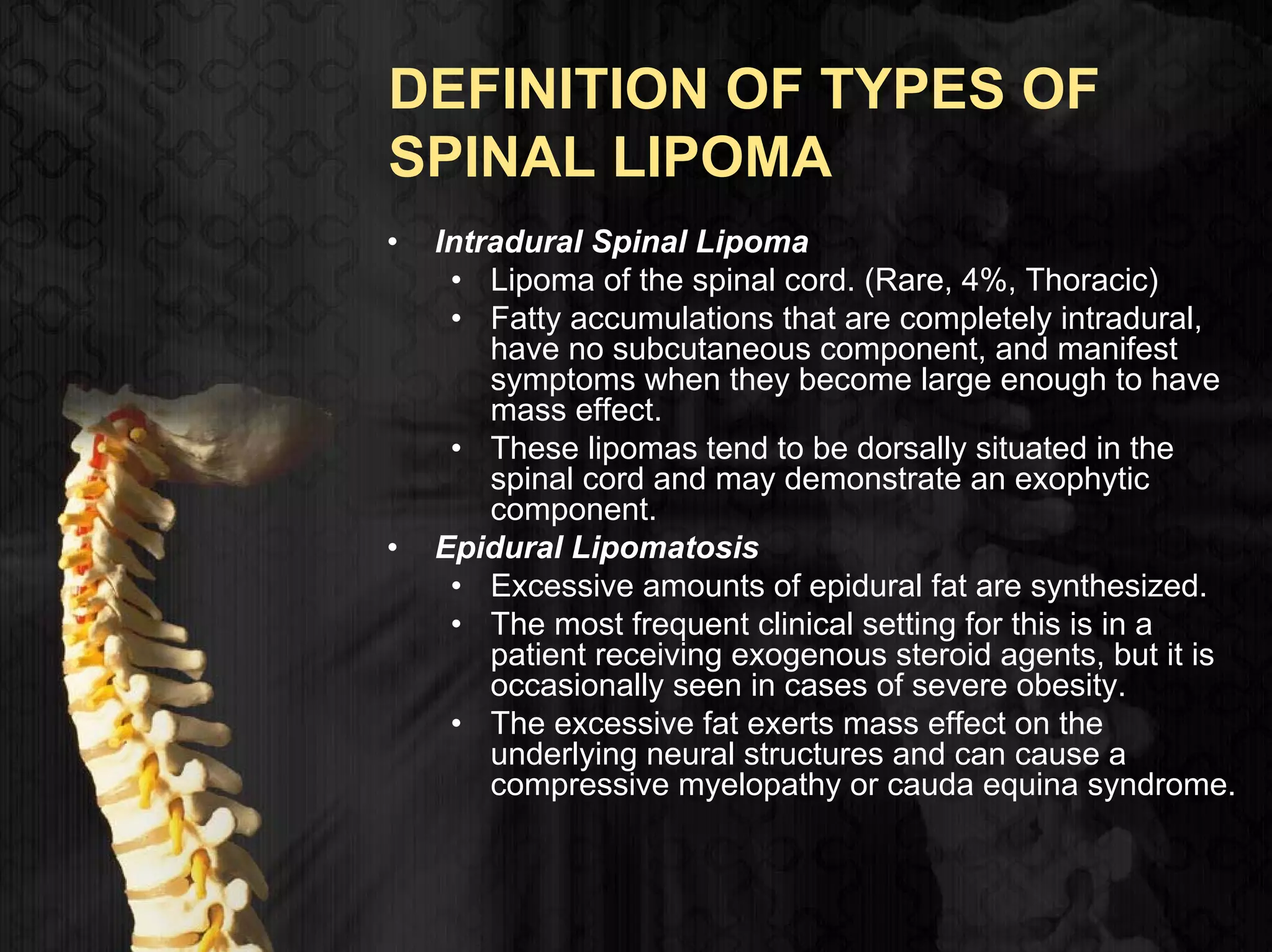 Lipomyelomeningocele | PDF