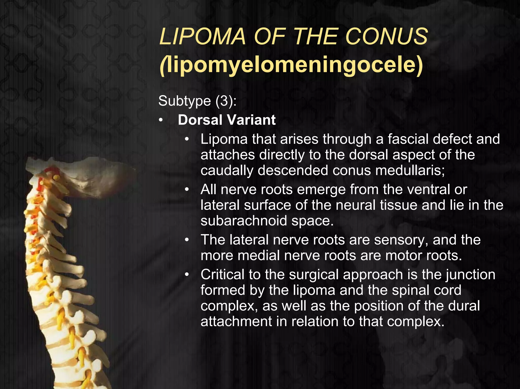 Lipomyelomeningocele | PDF