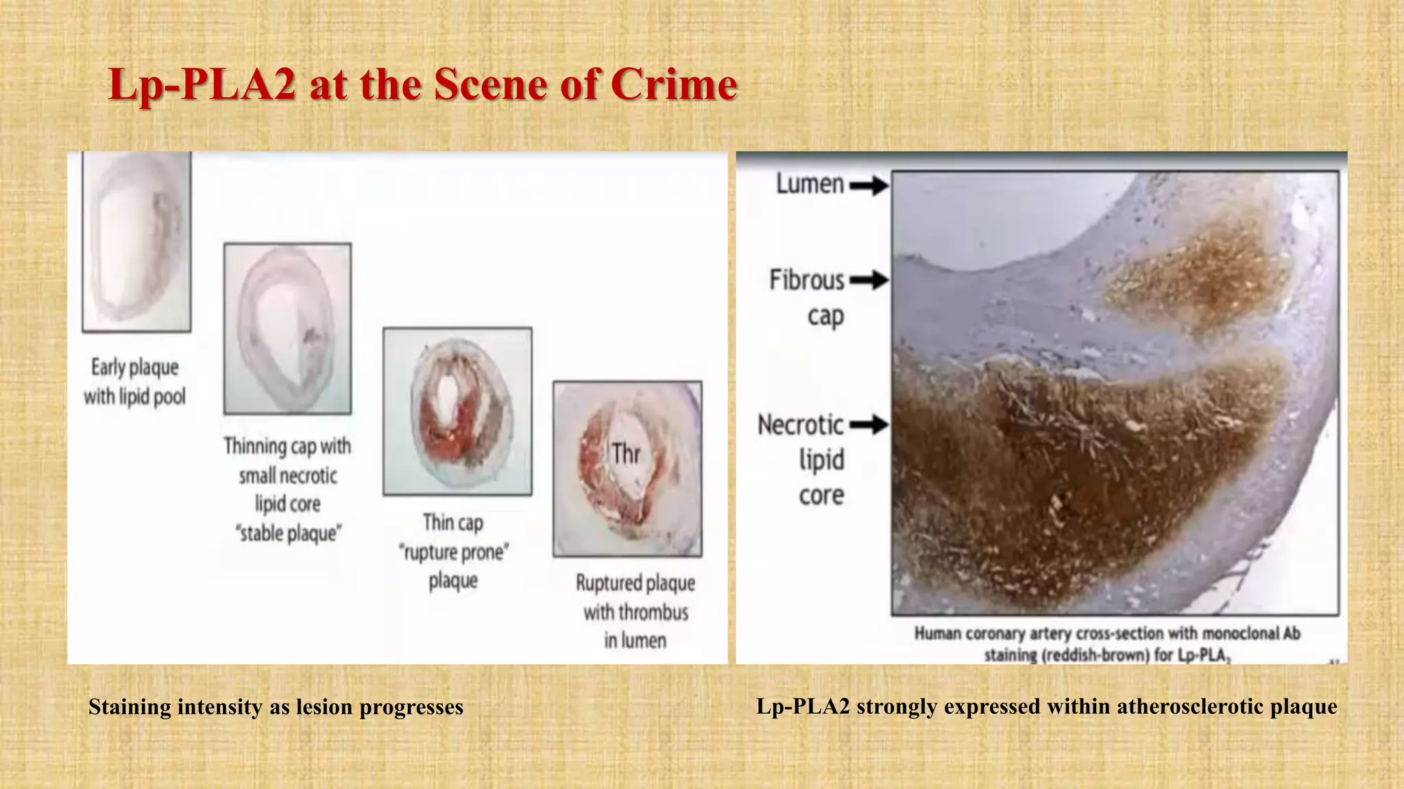 Lipoprotein associated phospholipase a2 | PPTX