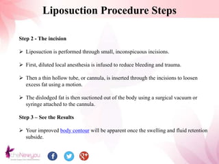 Liposuction | PPTX