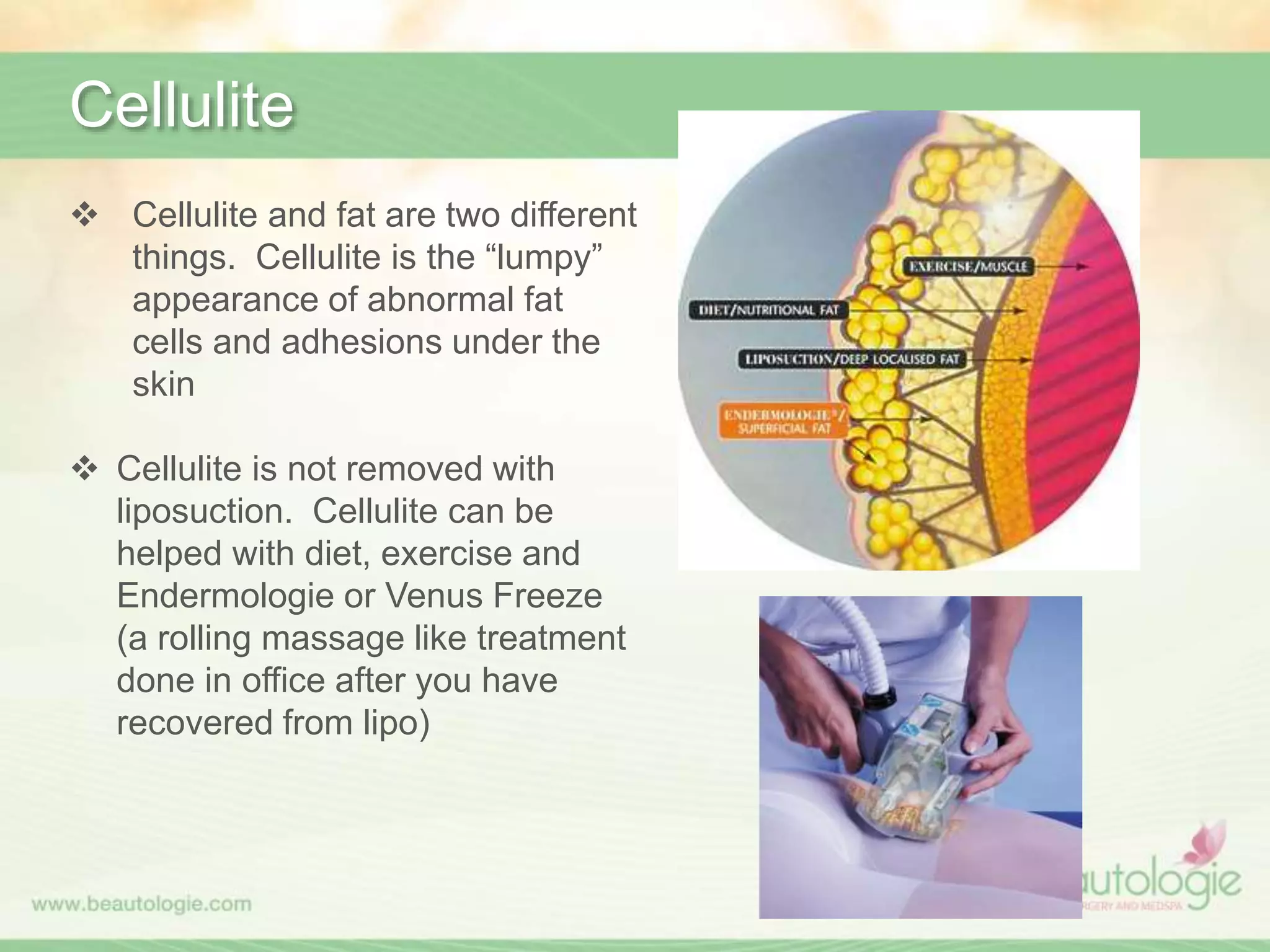 Liposuction by Beautologie Plastic Surgery | PPTX