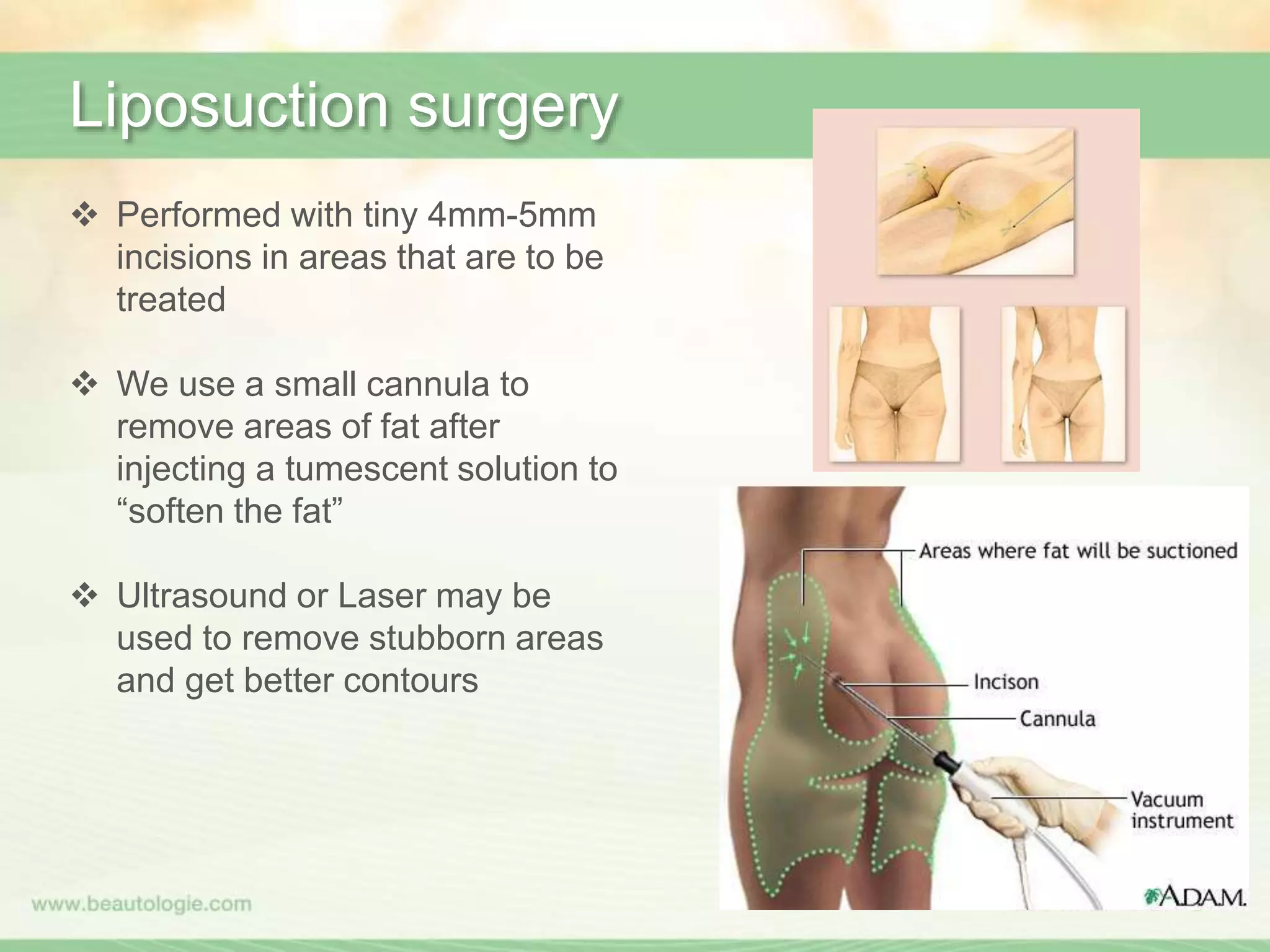 Liposuction by Beautologie Plastic Surgery | PPTX