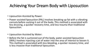 Liposuction.pptx