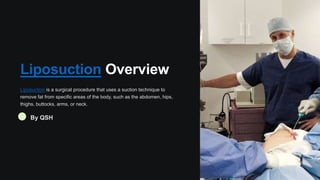 Liposuction-Overview.pptx