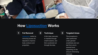 Liposuction-Overview.pptx