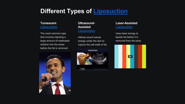 Liposuction-Overview.pptx