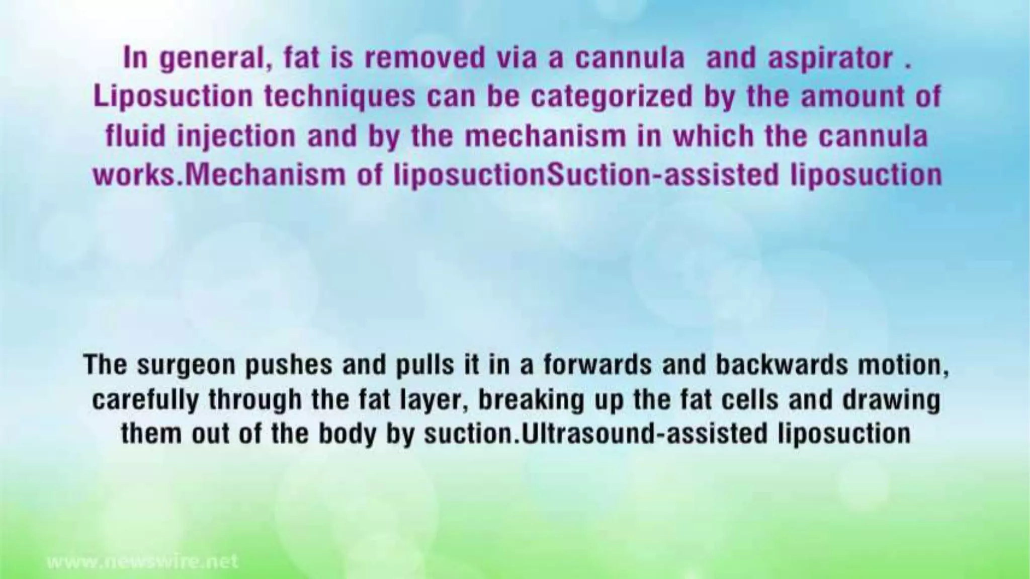 What are the Different Liposuction Techniques | PPTX