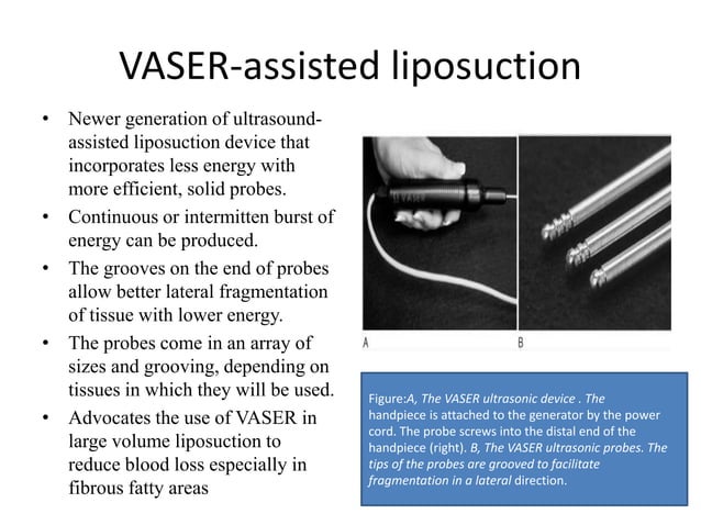 Liposuction by various method | PPTX | Skin and Dermatology | Diseases and Conditions
