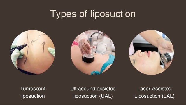 LIPOSUCTION SURGERY EVERYTHING YOU WANT TO KNOW | PPTX