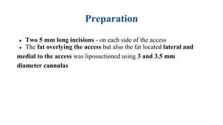 Liposuction used to treat deep vascular accesses for hemodialysis.pptx