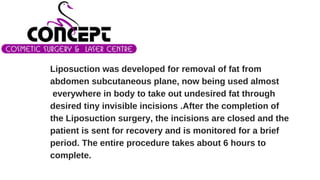Liposuction –vaser six pack correction | PDF | Cosmetic Medical ...