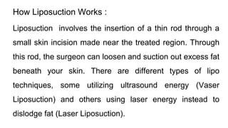 LIPOSUCTION VS TUMMY TUCK (1).pptx
