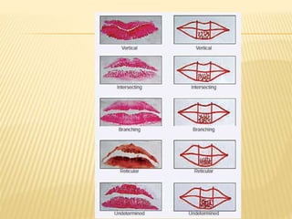 Lip prints | PPTX