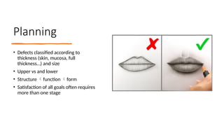 Lip Reconstruction: Algorithm for managing lip defects.pptx