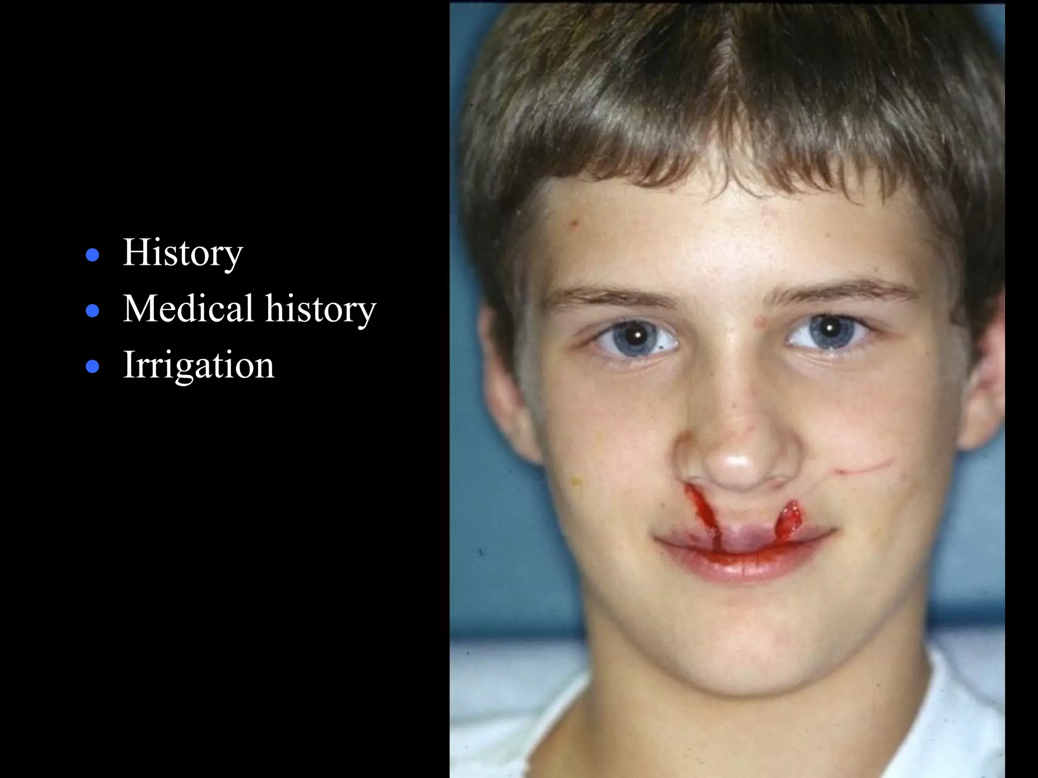 Lip Reconstruction Following Traumatic Lip Injuries | Dr. Alfred ...