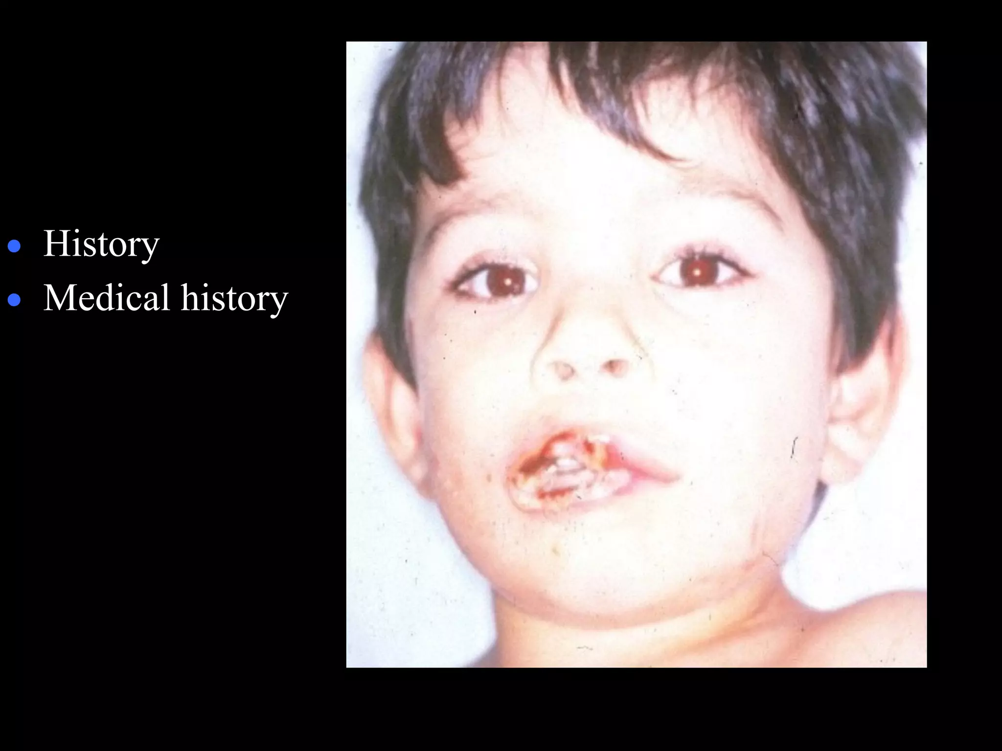 Lip Reconstruction Following Traumatic Lip Injuries | Dr. Alfred ...