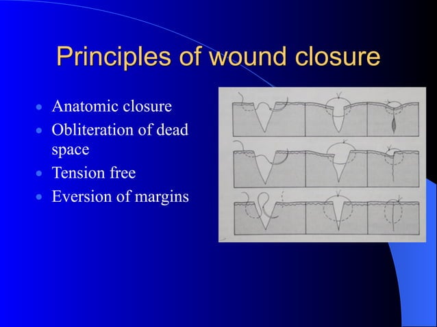 Lip Reconstruction Following Traumatic Lip Injuries | Dr. Alfred ...