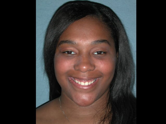 Lip Reconstruction Following Traumatic Lip Injuries | Dr. Alfred ...