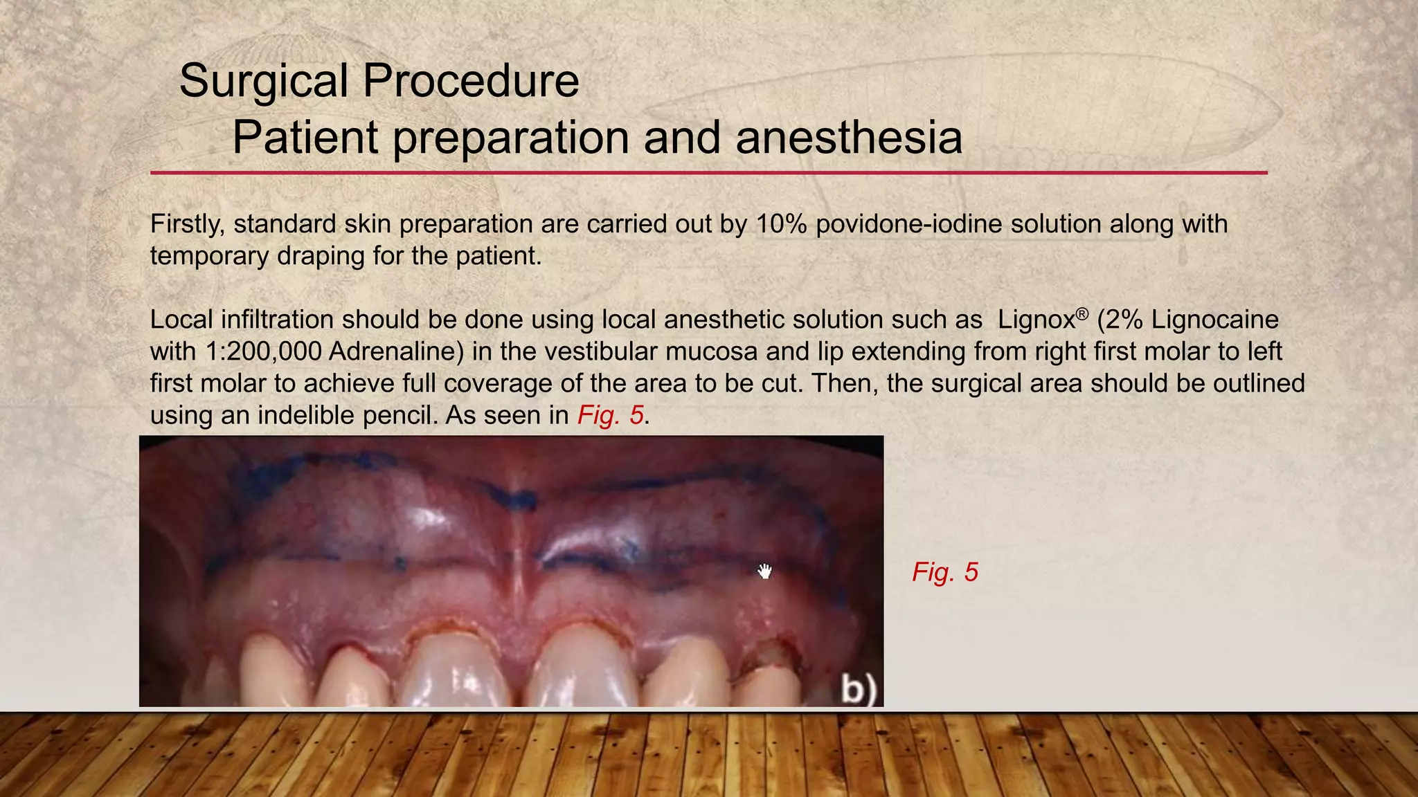 Lip Repositioning flap.pptx