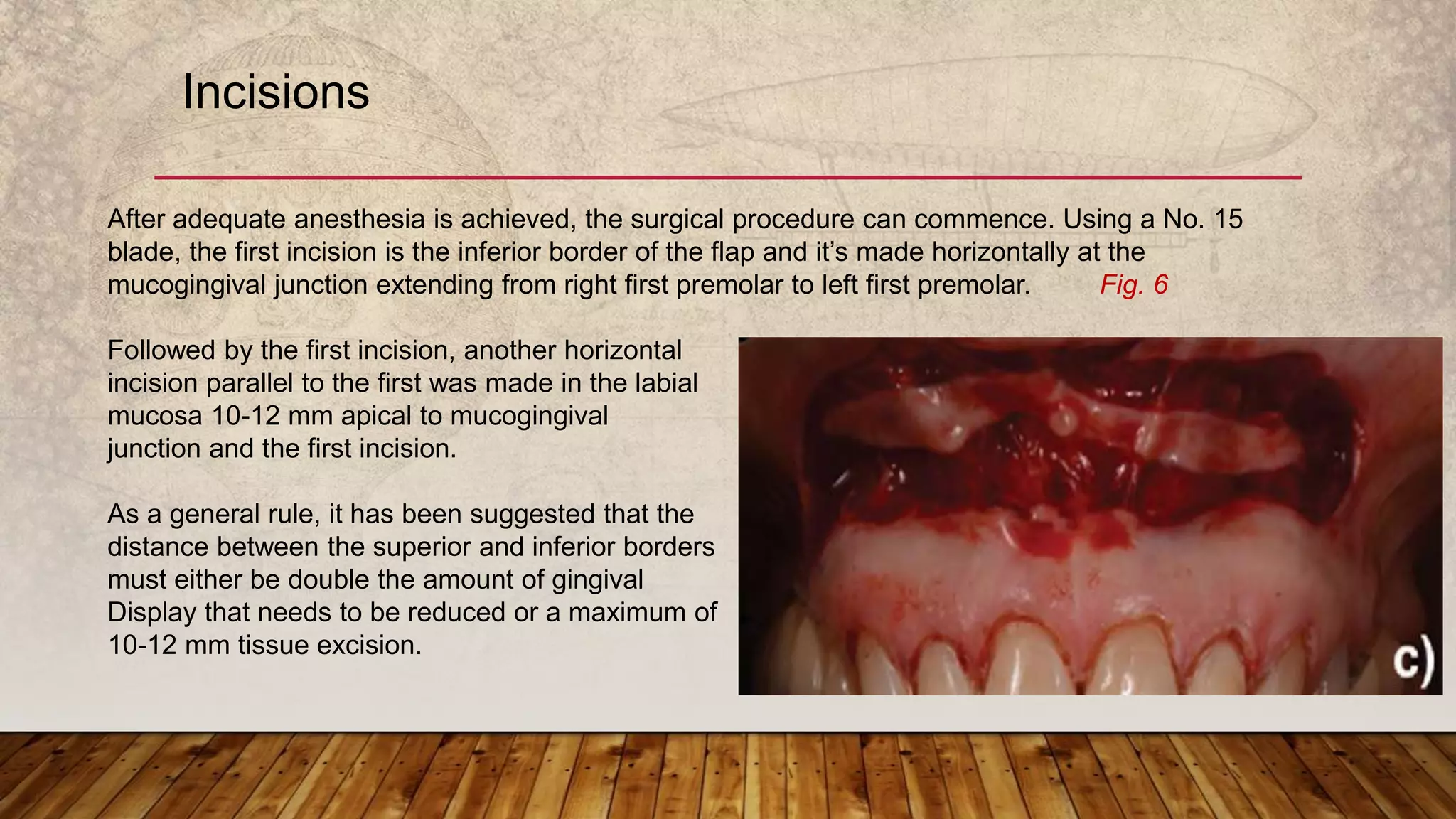 Lip Repositioning flap.pptx