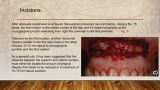 Lip Repositioning flap.pptx
