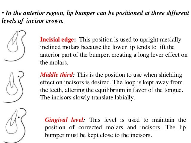 lip bumper by Sakshi Agarwal