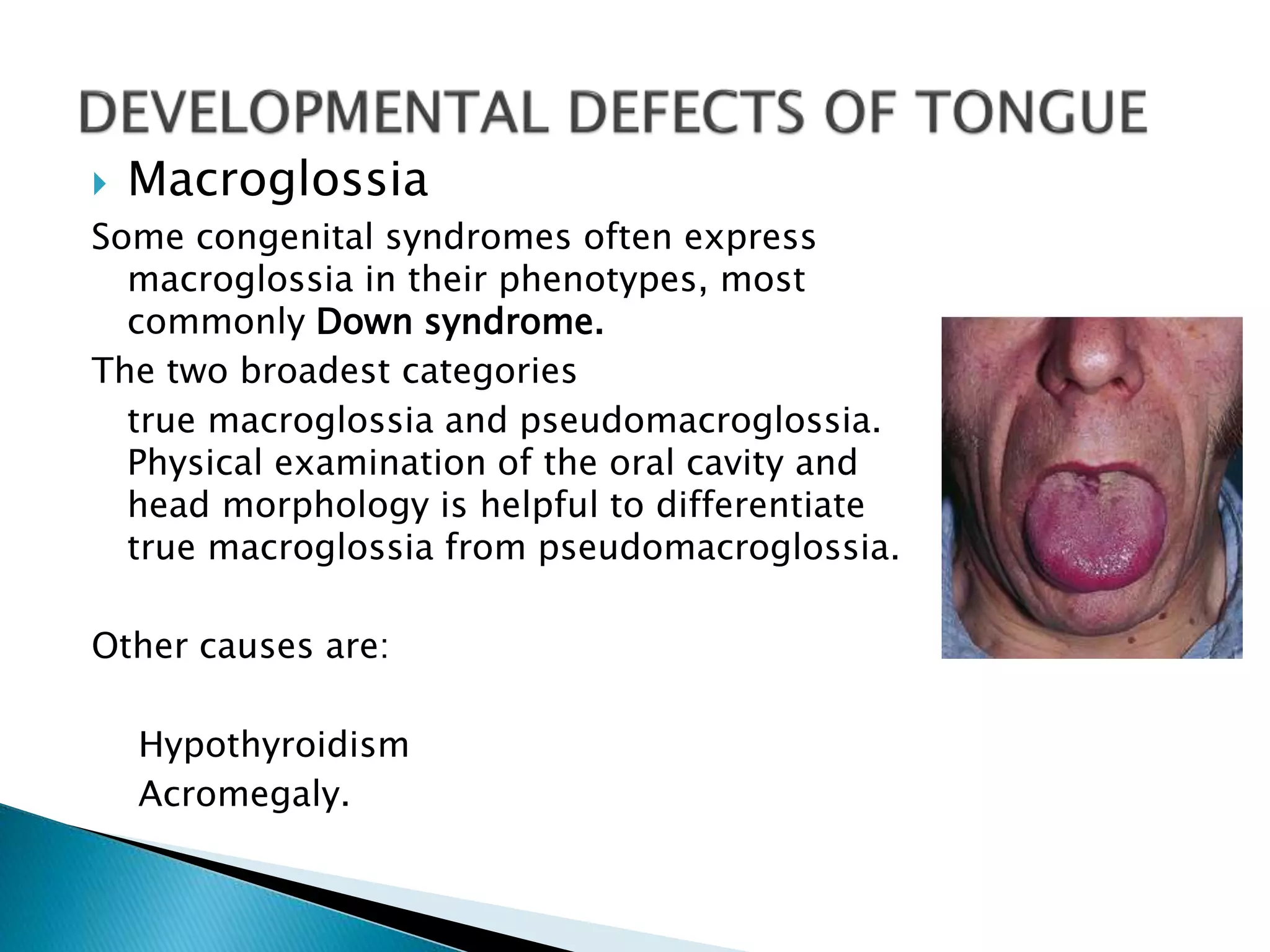 Lips tongue and palate | PPTX