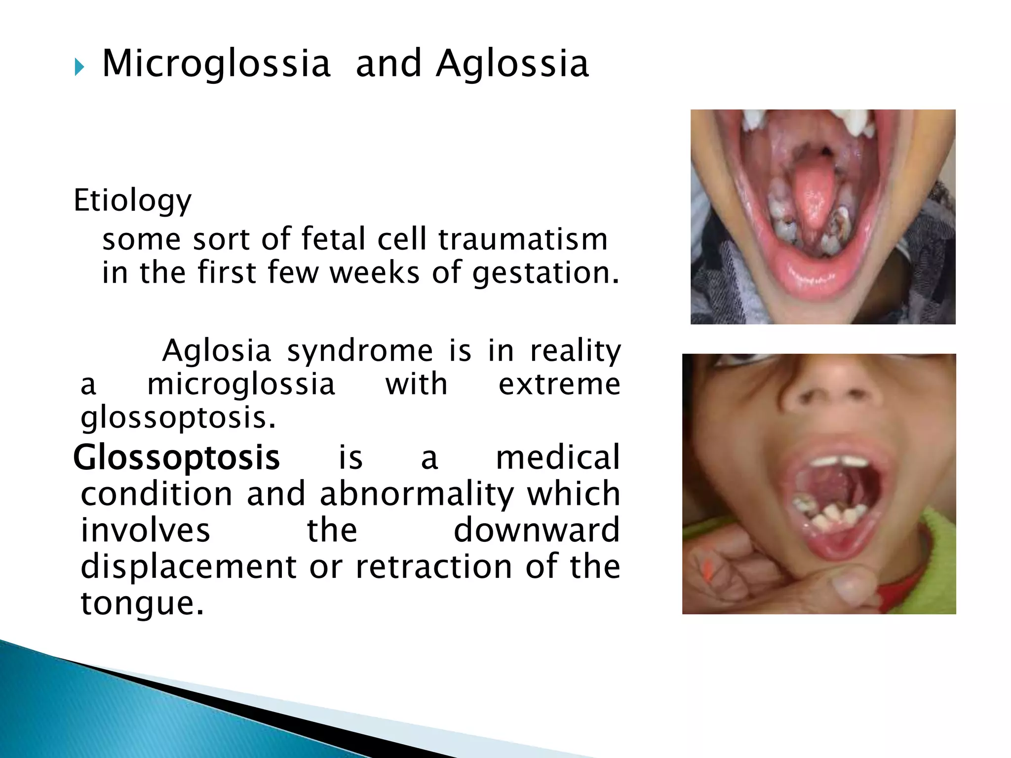 Lips tongue and palate | PPTX