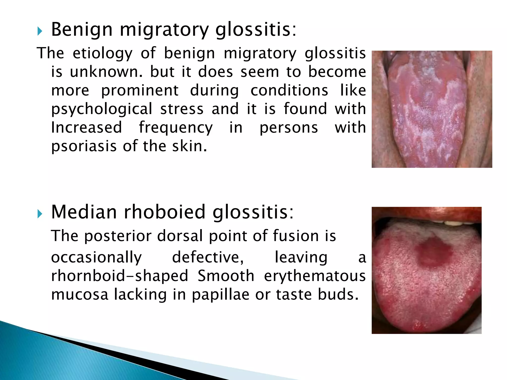Lips tongue and palate | PPTX