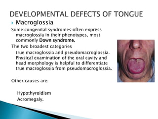 Lips tongue and palate | PPTX
