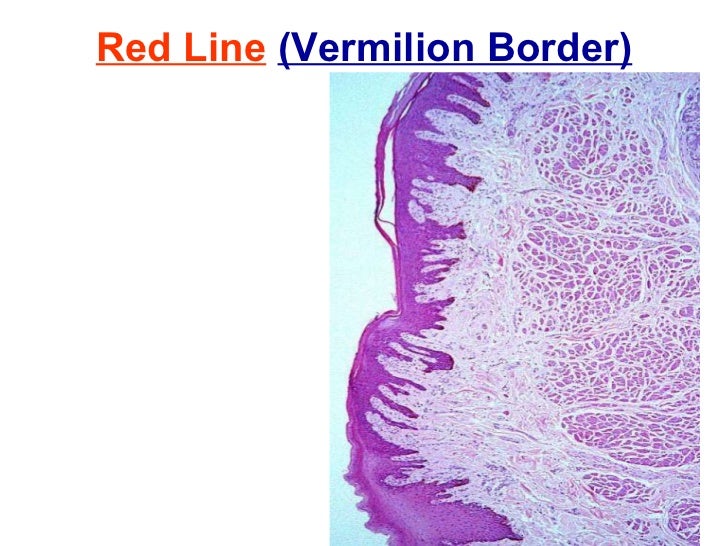 Vermilion Border Lip