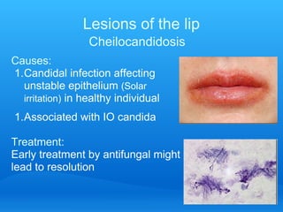 Lip tongue lesions...quick summary | PPT