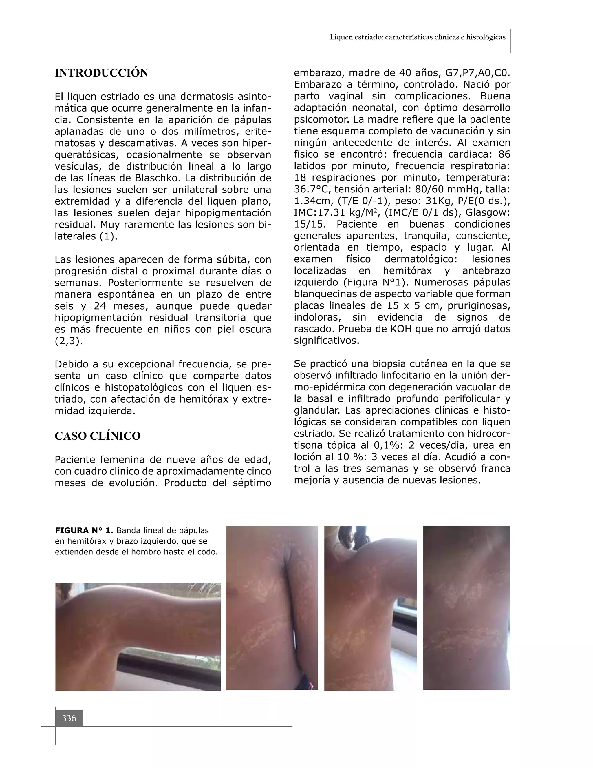 Liquen estriado caracteristicas clinicas e histologicas | PDF