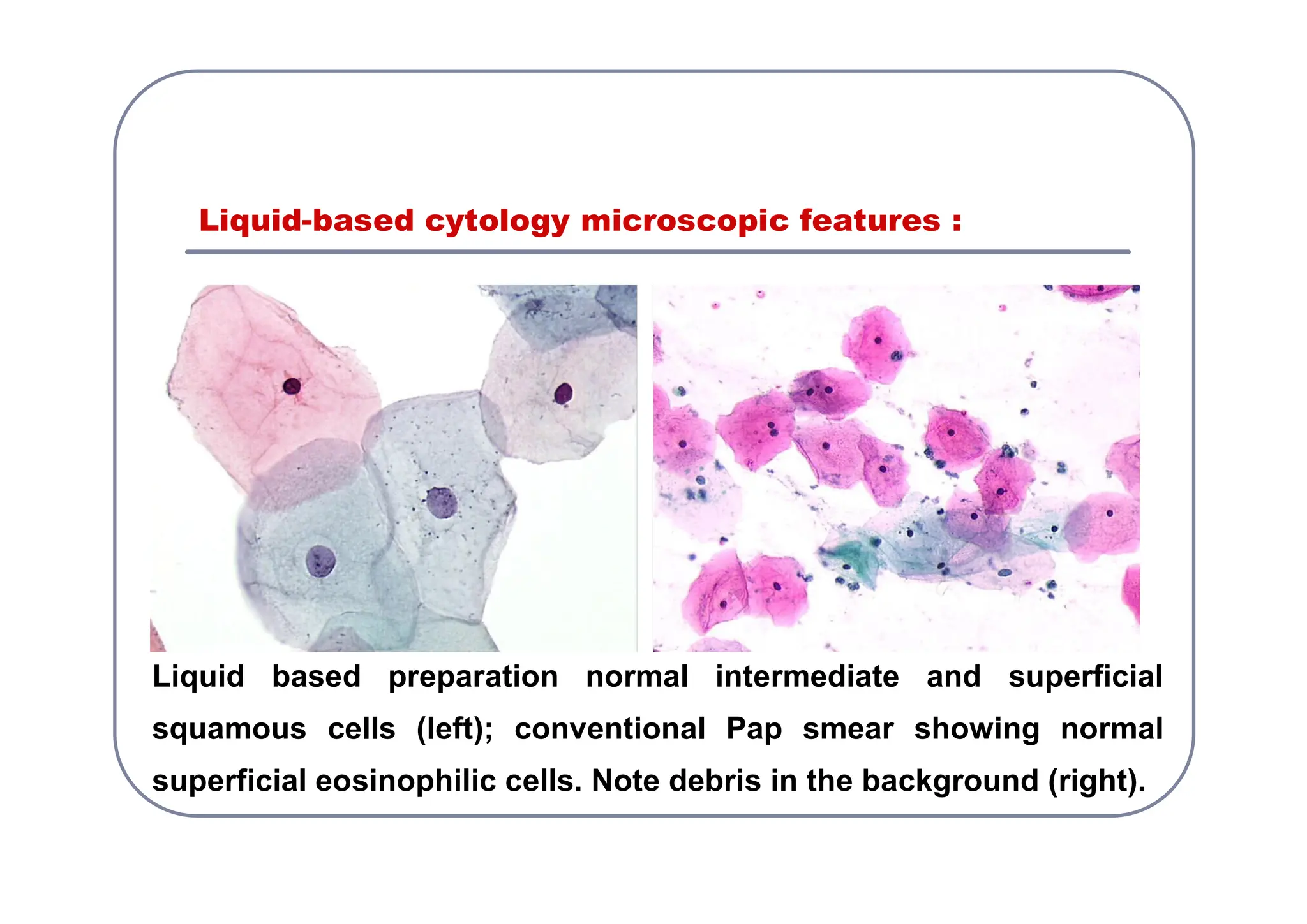 Liquid-based-cytology-Abd-El-Hafez-2010.pdf