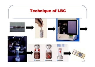 Liquid-based-cytology-Abd-El-Hafez-2010.pdf
