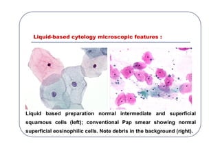 Liquid-based-cytology-Abd-El-Hafez-2010.pdf