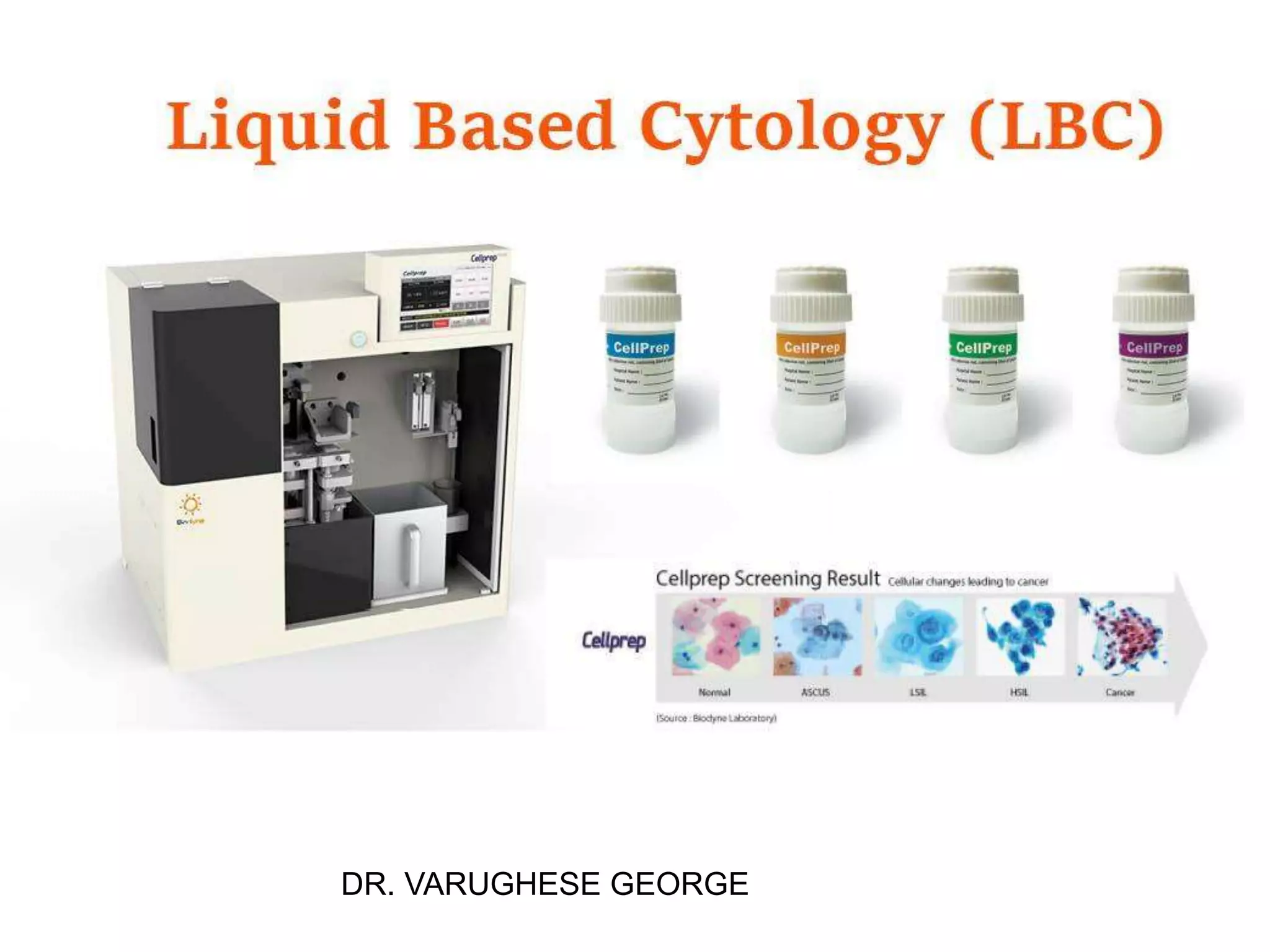 Liquid based cytology | PPTX