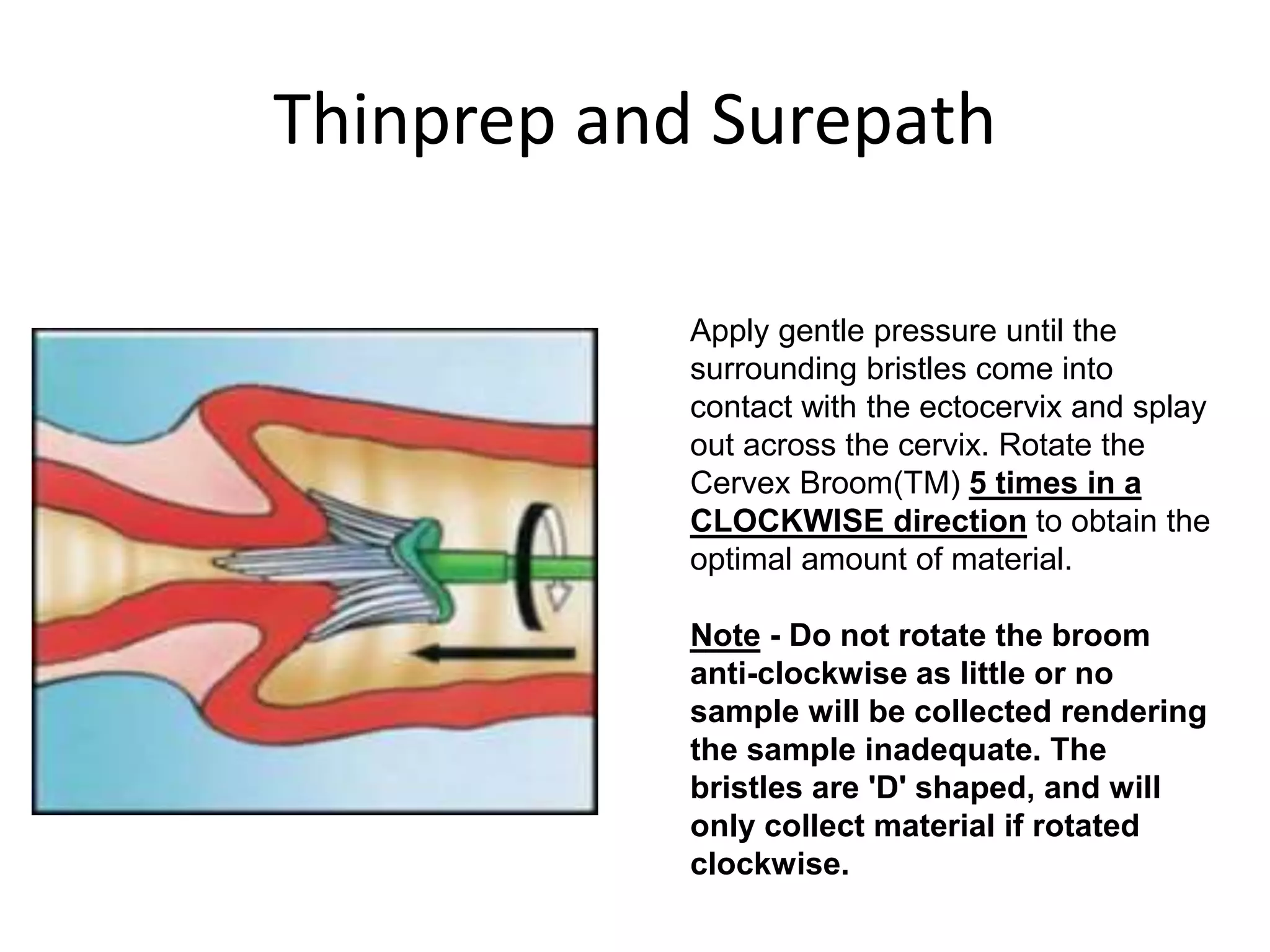 Liquid based cytology | PPTX