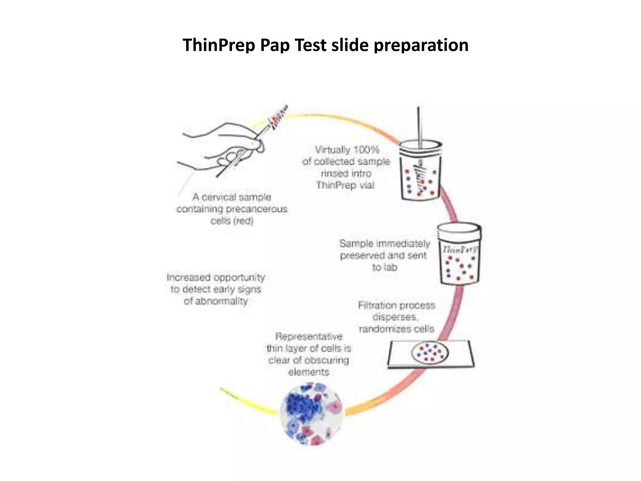 Liquid based cytology | PPTX
