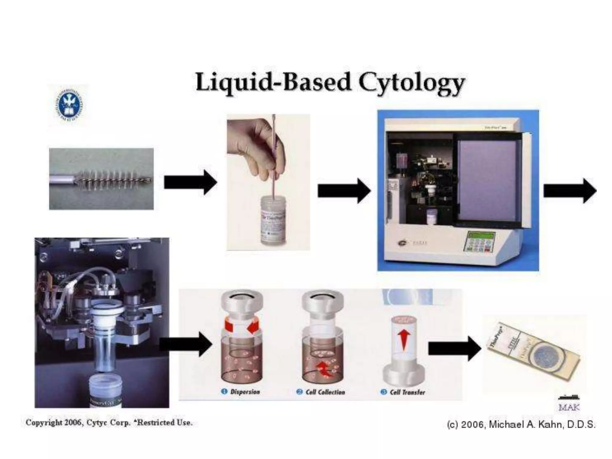 Liquid based cytology | PPTX | Medical Tests | Medical Health