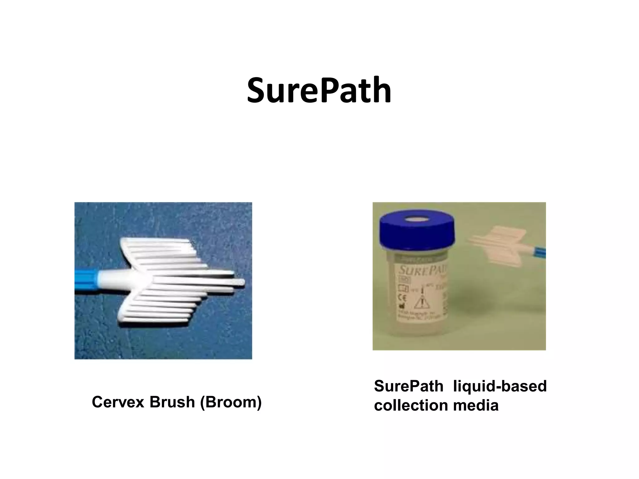 Liquid based cytology | PPTX