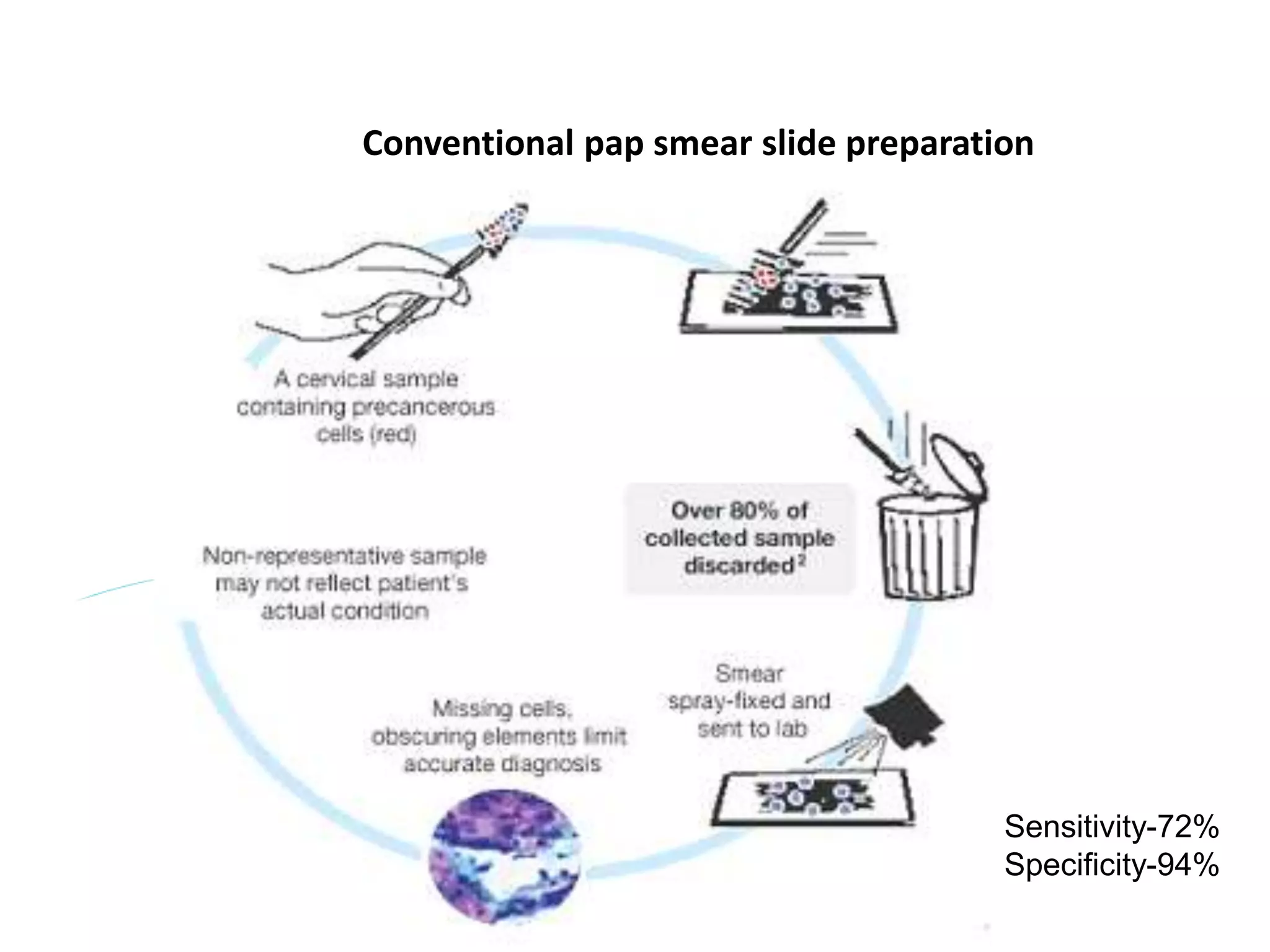 Liquid based cytology | PPTX