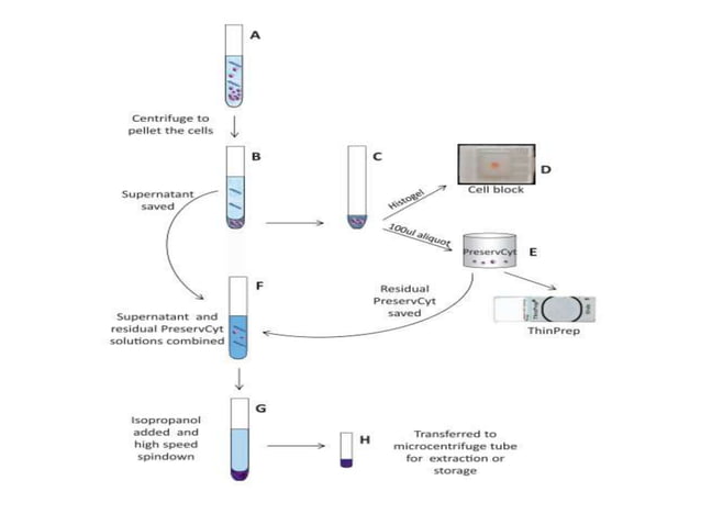 Liquid based cytology | PPTX | Medical Tests | Medical Health