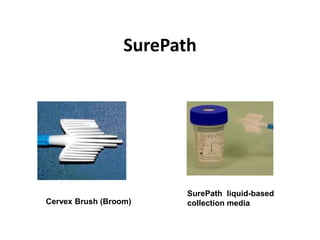 Liquid based cytology | PPTX