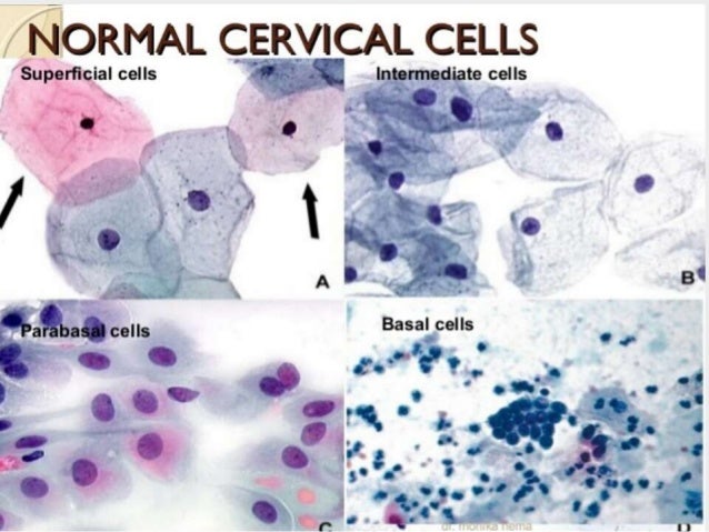 Liquid based cytology