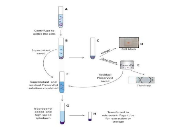 Liquid based cytology