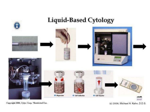 Liquid based cytology